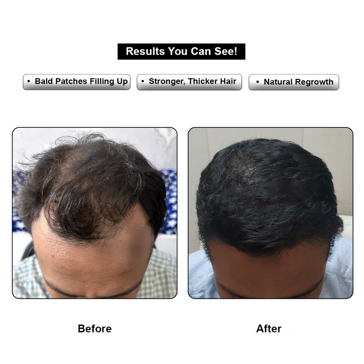 Follicle Booster - Hair ReGrowth Serum | Care Damn